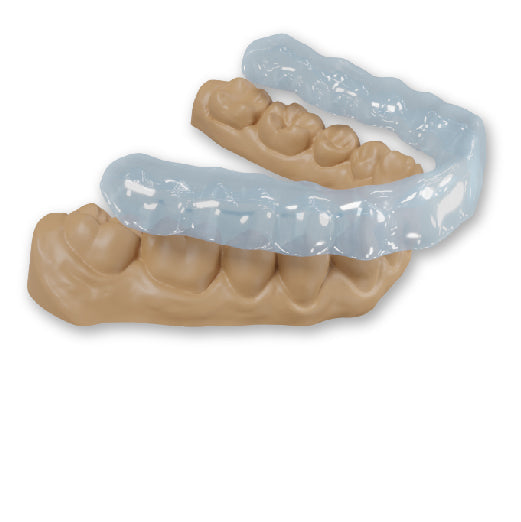 Splint – MONSTER MILLING